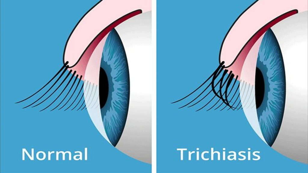 หน้าแรก - The Wisdom Optic